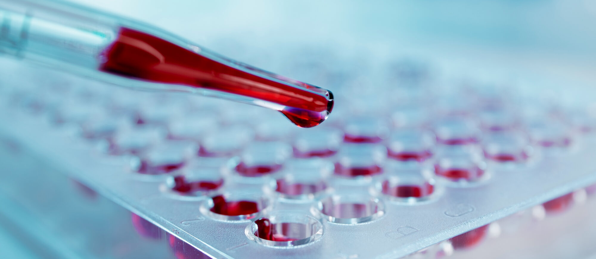 ANALISI SANGUE VENOSO - LABORATORIO ITALIANO DI TOSSICOLOGIA